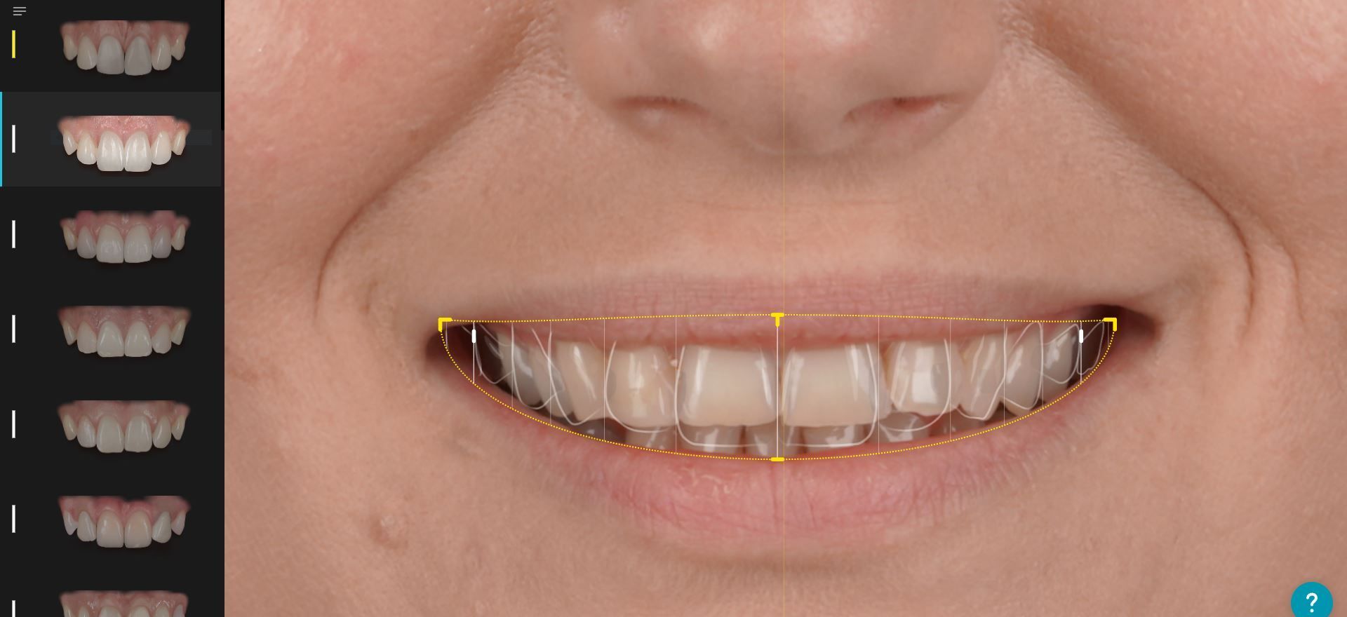 Innovativer Design-Workflow mit der Smilecloud - Ihr Dentallabor in ...